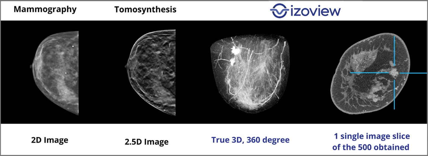 Breakthrough 3D Breast Cancer Imaging Company Establishing New R&D ...